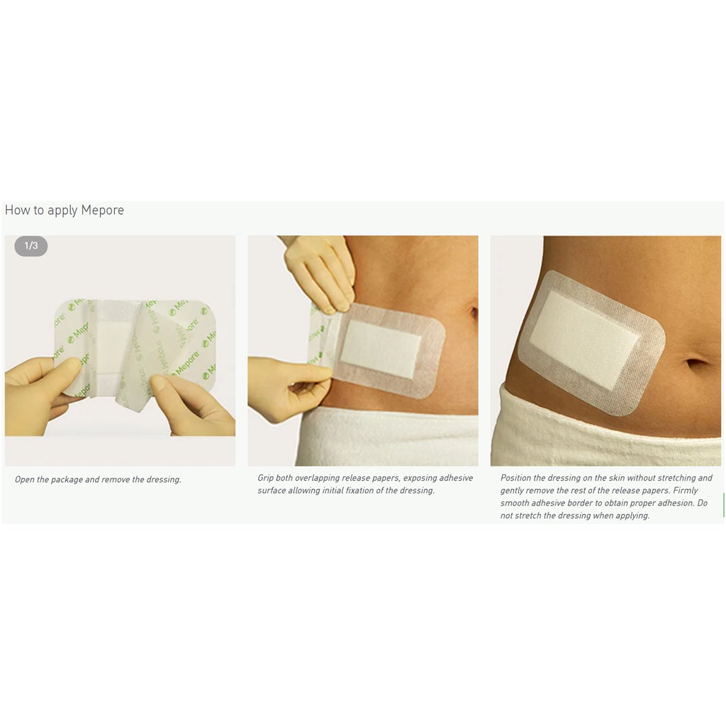Mepore® Adhesive Dressing, 2½ x 3 Inch – eMedical Kits