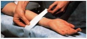 Halyard OR Armboard Cover – eMedical Kits